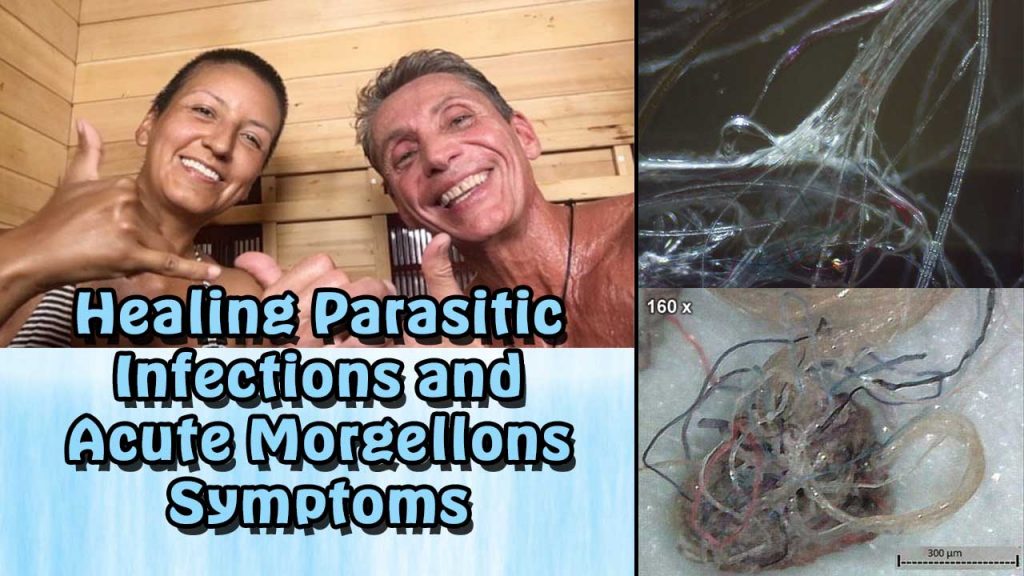 Healing Parasitic Infections and Acute Morgellons Symptoms - Earther ...