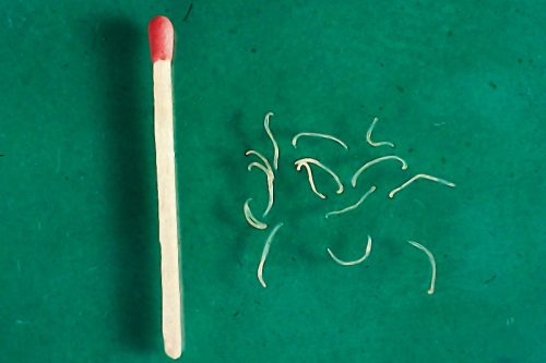 Enemas For Parasite And Toxicity Removal - Earther Academy